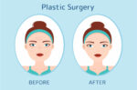 10 Plastic Surgery Flat Illustration - MasterBundles