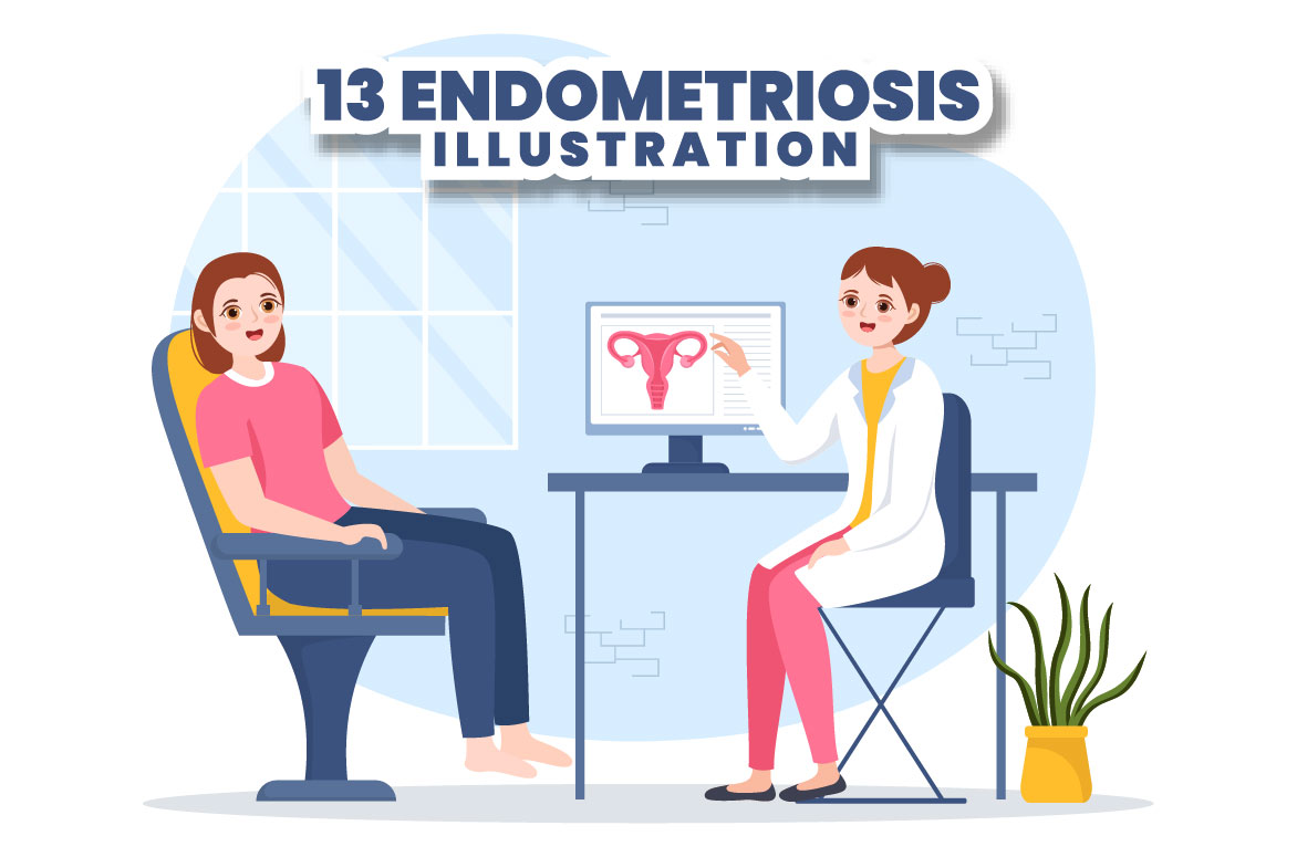 13 Endometriosis Illustration - MasterBundles