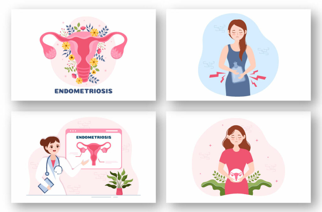 13 Endometriosis Illustration - MasterBundles