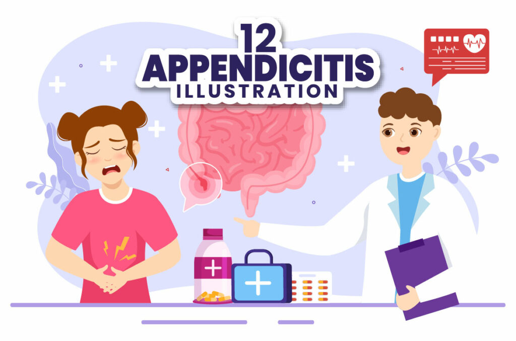12 Appendicitis Inflammation Illustration - MasterBundles