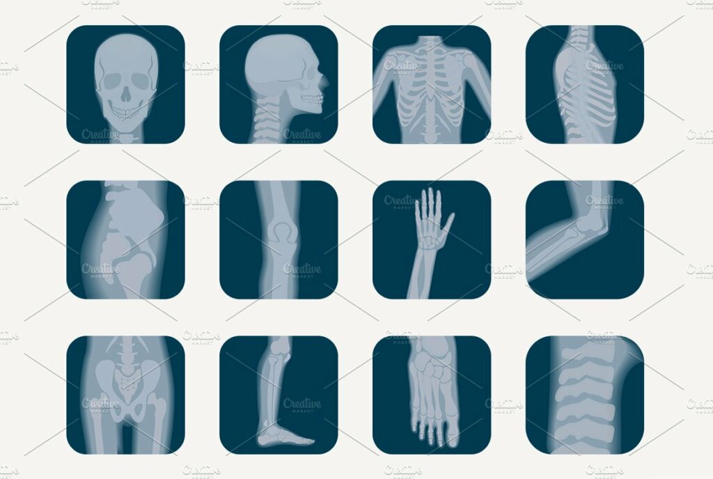 X-rays skeleton shots + icons – MasterBundles