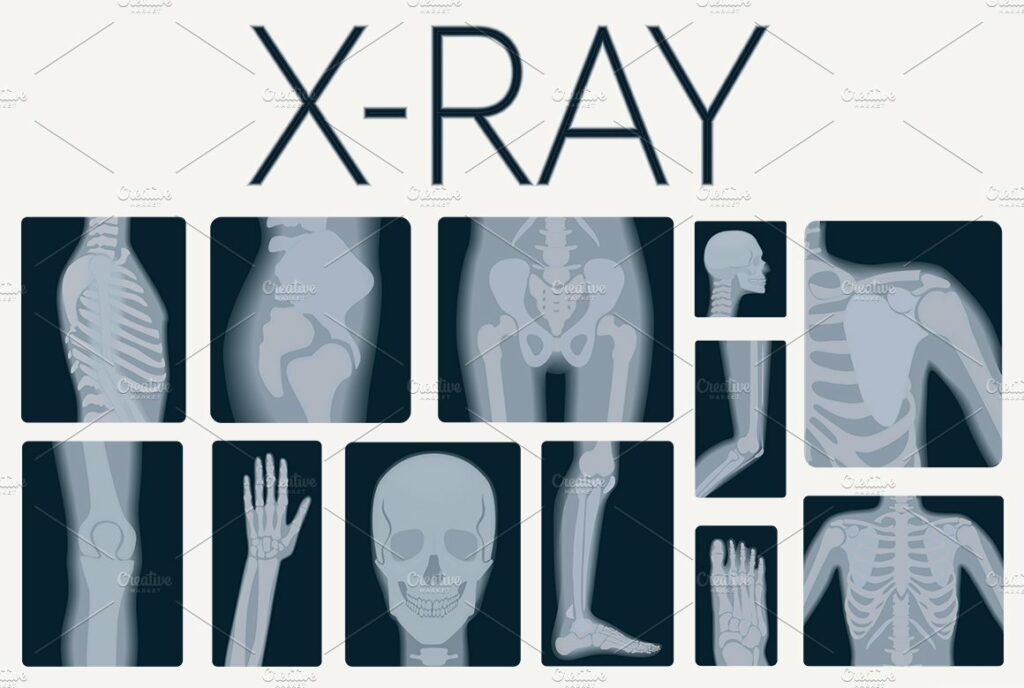 X-rays skeleton shots + icons – MasterBundles