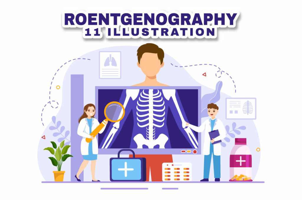 11 Roentgenography Vector Illustration - MasterBundles