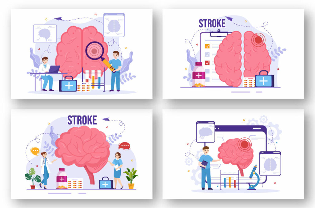 12 Human Brain Stroke Illustration - MasterBundles