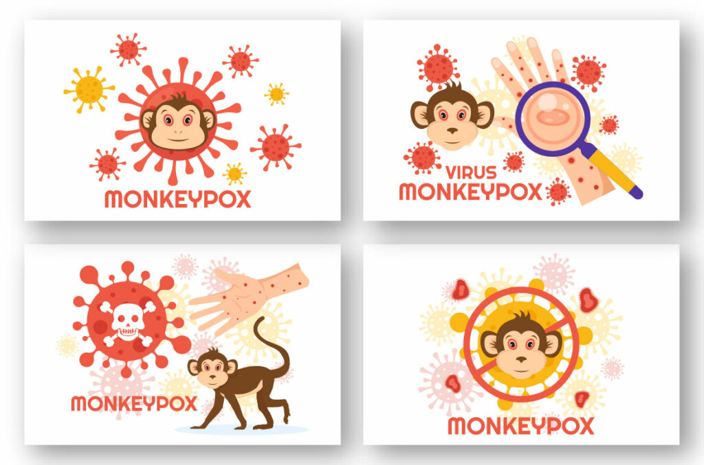 12 Monkeypox Outbreak Illustration - MasterBundles