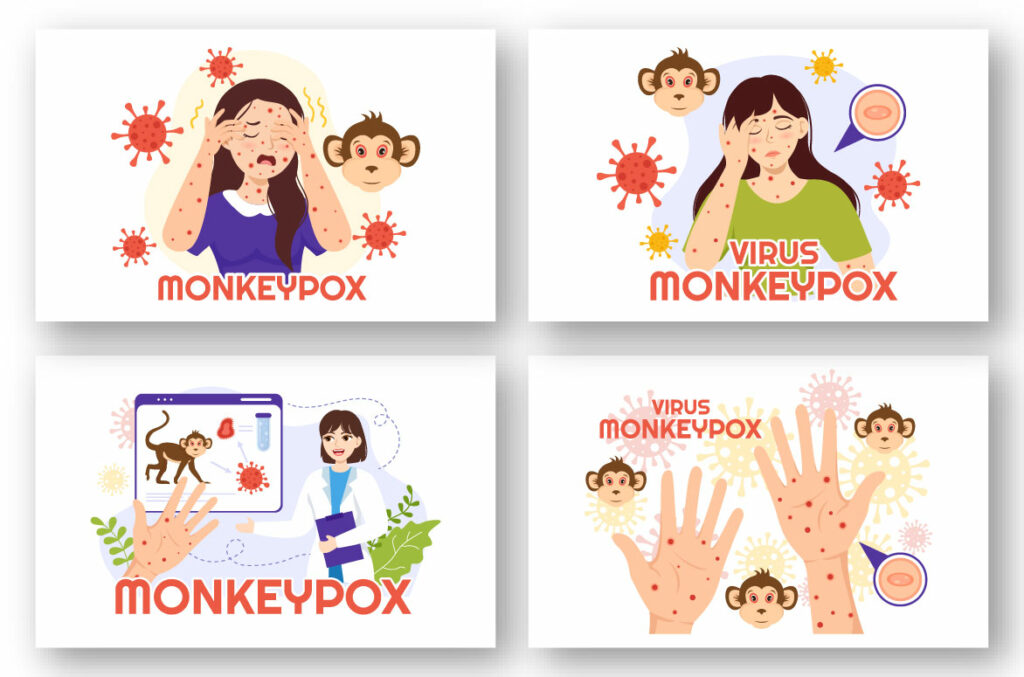 12 Monkeypox Outbreak Illustration - MasterBundles