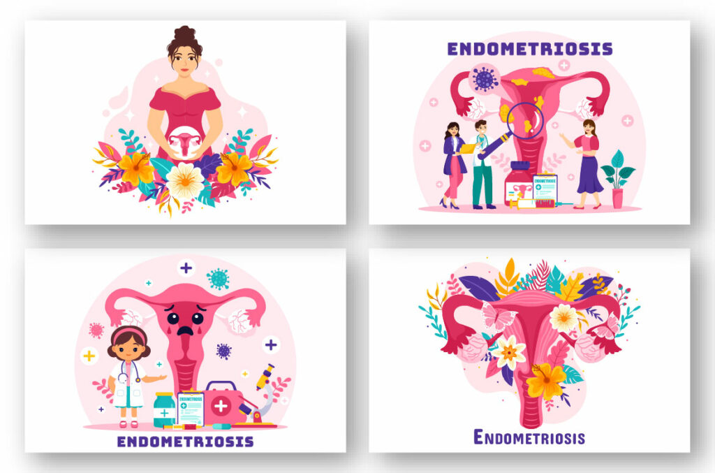 12 Endometriosis Illustration - MasterBundles