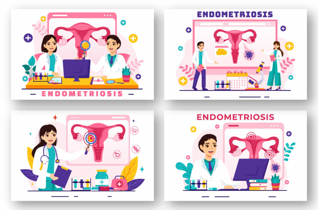 12 Endometriosis Illustration - MasterBundles