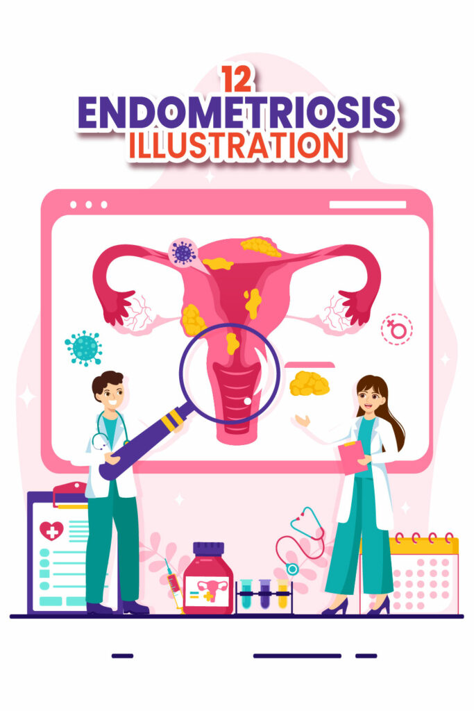 12 Endometriosis Illustration - MasterBundles