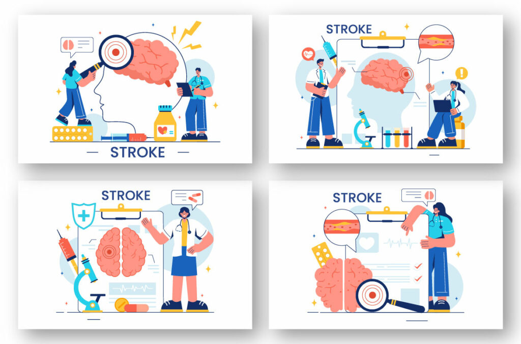 12 Human Brain Stroke Illustration - MasterBundles