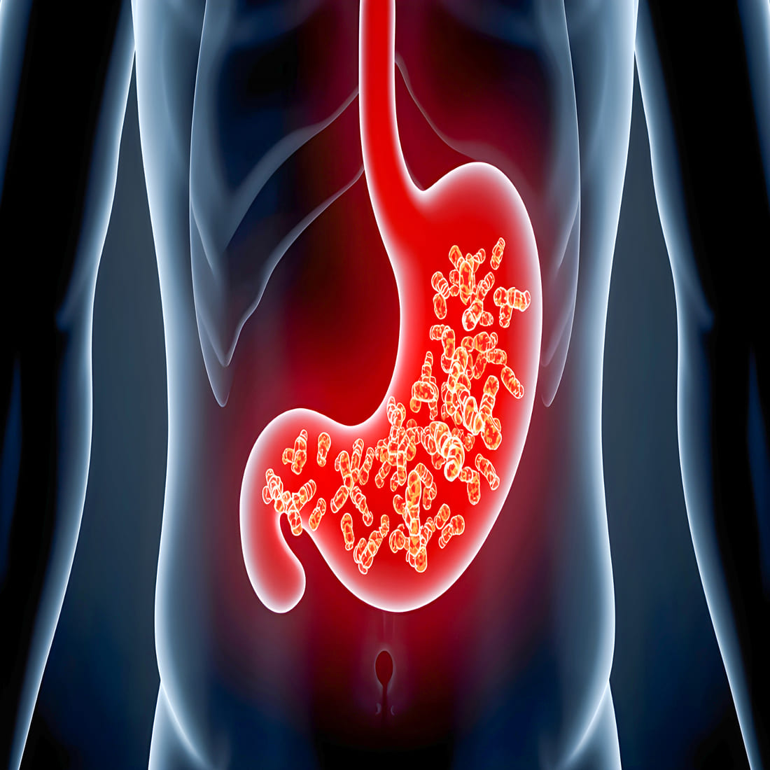 Digestive System Diseases Medical Illustration Bundle, Gut Health ...