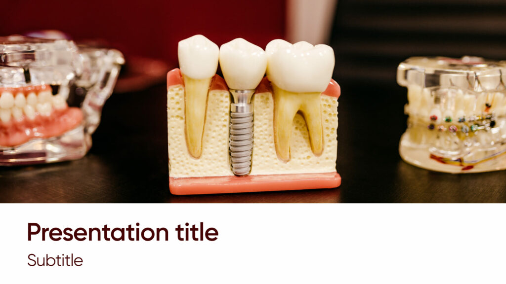 Free Dental Implants Powerpoint – MasterBundles