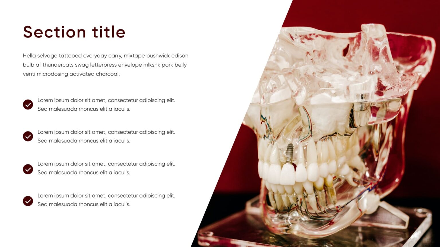 Free Dental Implants Powerpoint – MasterBundles